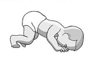 STNR & ATNR Reflex | BRMT Canada